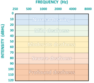 Understanding the Audiogram - Support for schools and settings